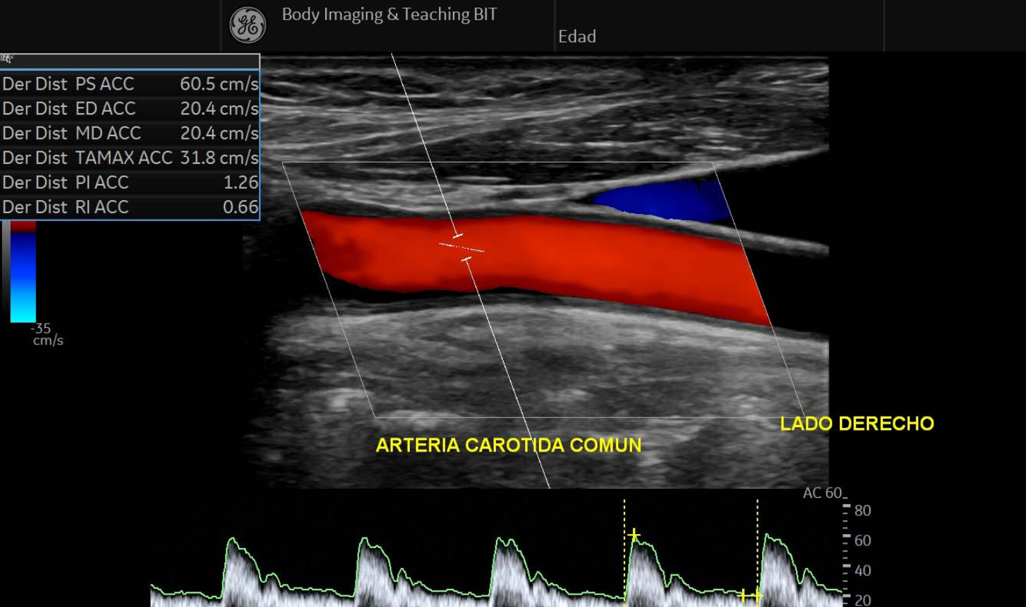 ¿QUÉ ES EL ULTRASONIDO DOPPLER? - Body Imaging & Teaching